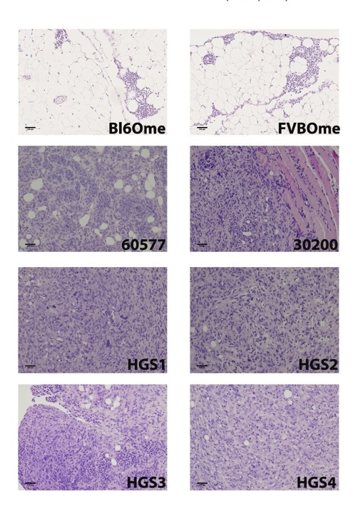 Ovarian cancer | CancerTools.org