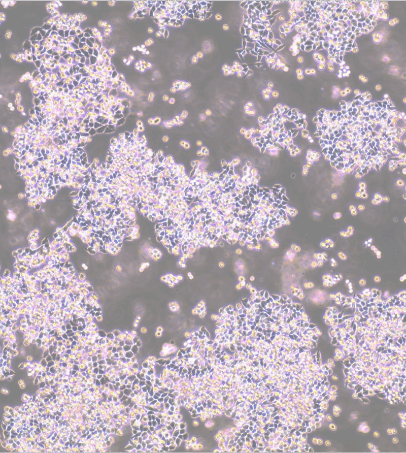 MB49 murine bladder carcinoma cell line | CancerTools.org
