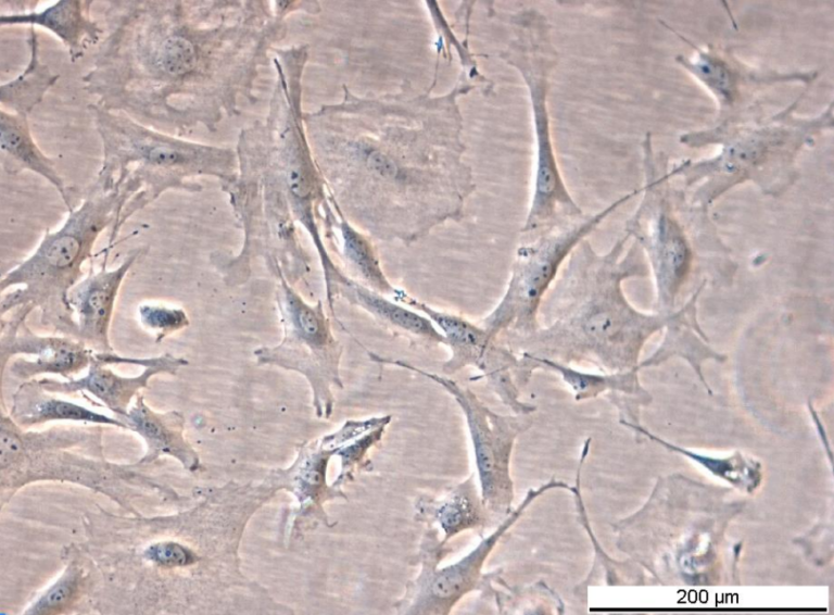 A2780 Cell Line | CancerTools.org